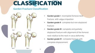 SLIDE CASE REPORT NECK FEMUR FRACTURE | PPT