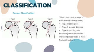 SLIDE CASE REPORT NECK FEMUR FRACTURE | PPT