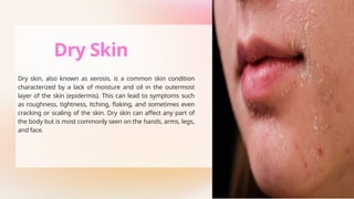 addressing dry skin, acne, sun protection,pigmentation, prickly heat ...