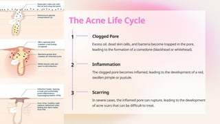 addressing dry skin, acne, sun protection,pigmentation, prickly heat ...