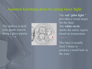 Hatching | PPT