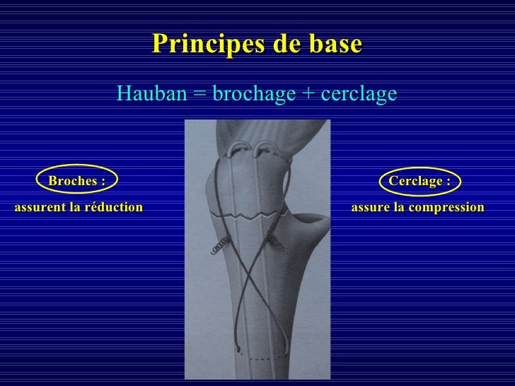 Broches de Lefevre brochure