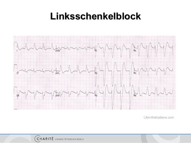 EKG-Grundlagen: 2015 (www.fokus-ekg.de)