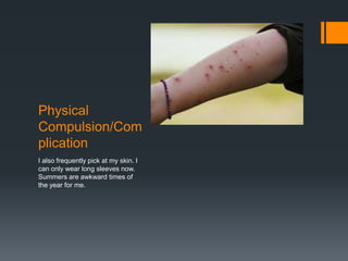 Having obsessive compulsive disorder | PPTX