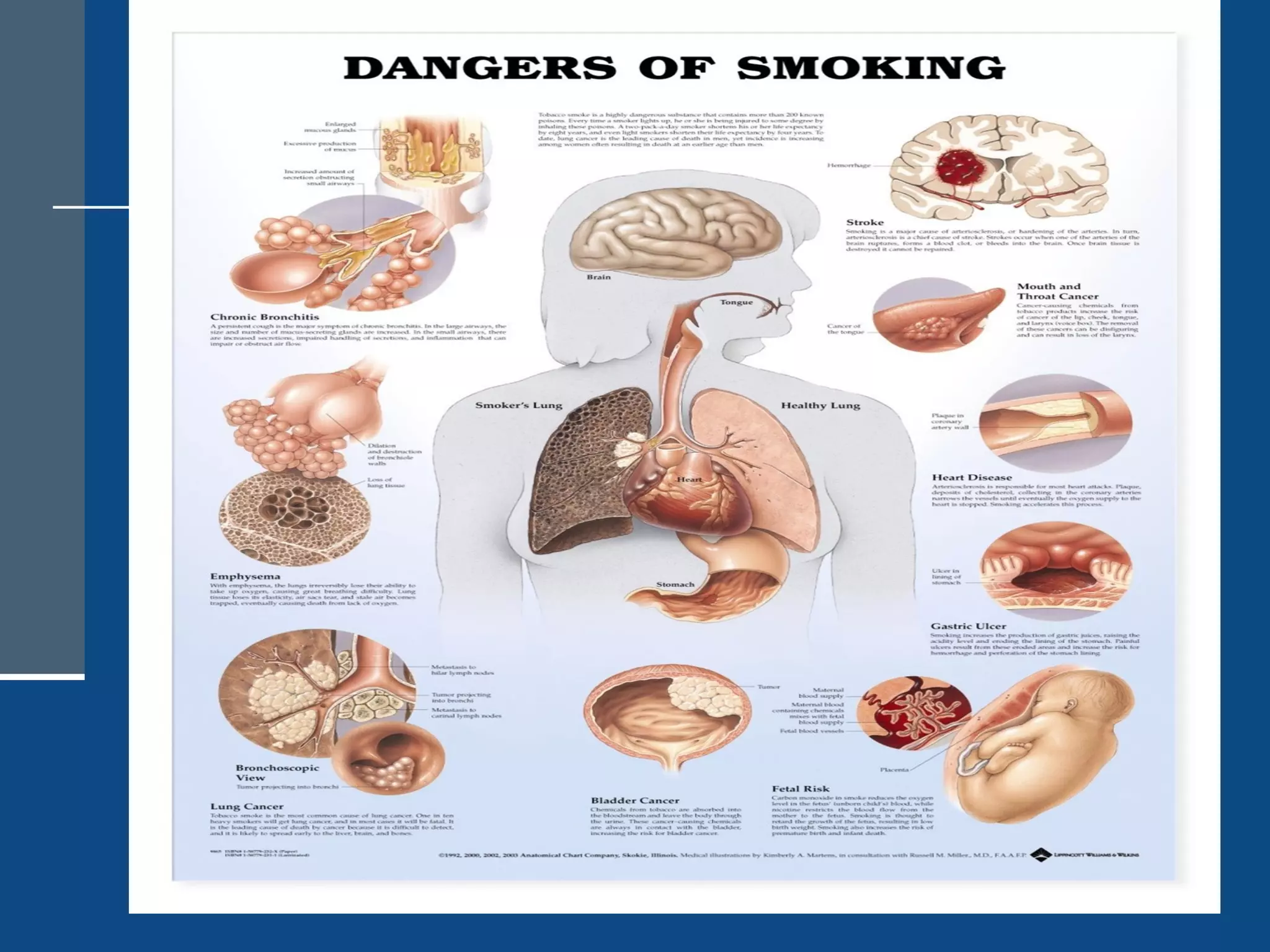 Effects of Tobacco on Health | PPT
