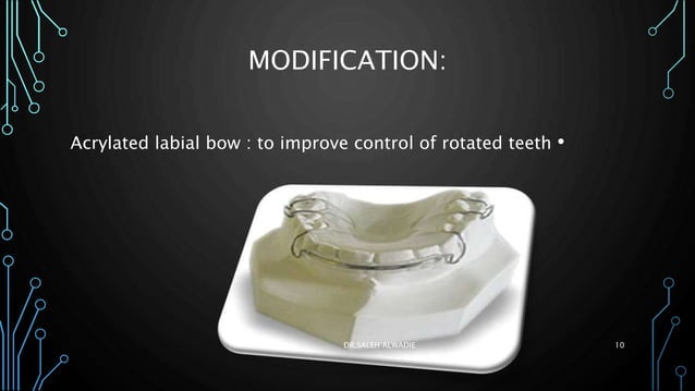 Hawley retainer | PPTX