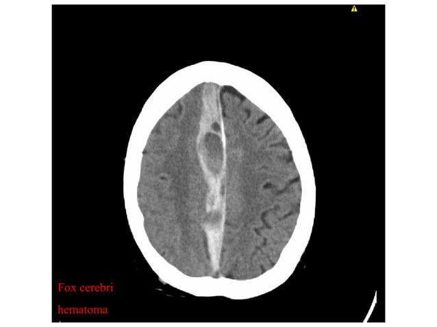 A Root Cause Analysis of a Fall | PPT | Medical Health