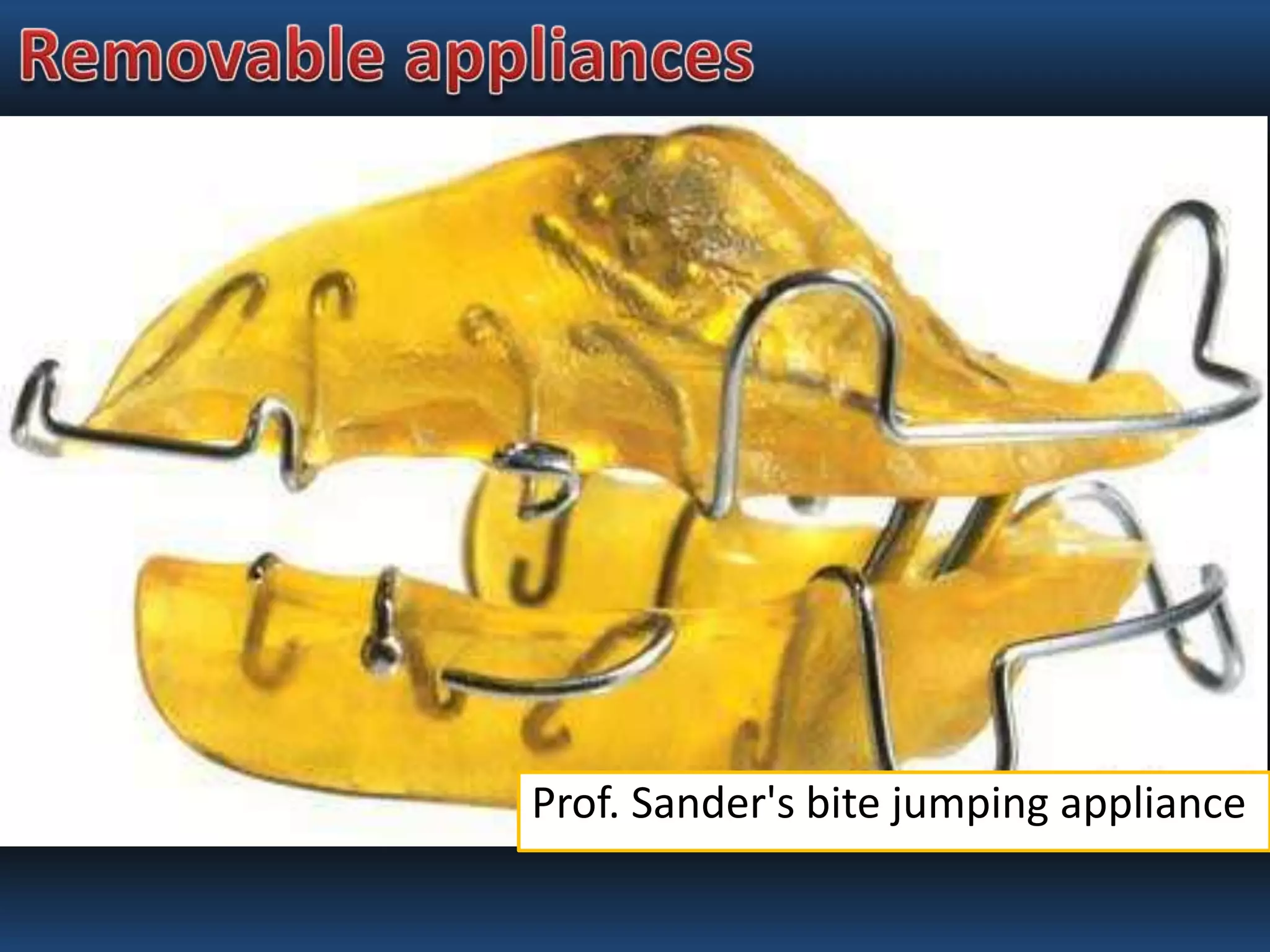 Hazards of swallowing orthodontic appliances | PPTX