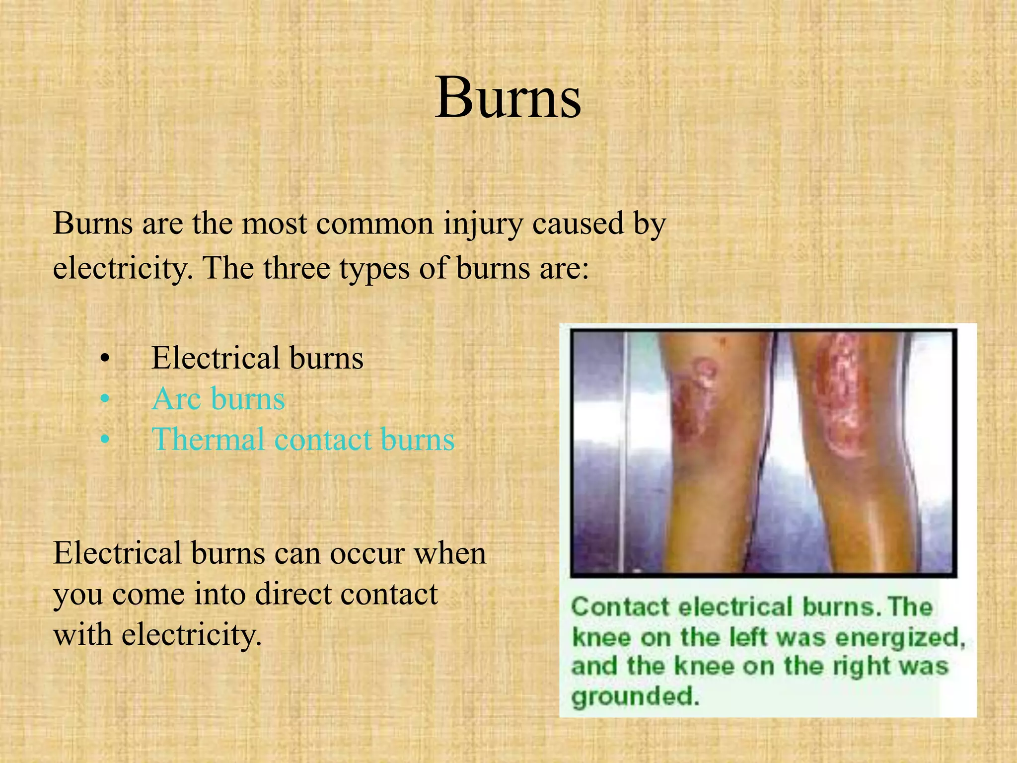 Electrical Hazards and their safety | PPSX