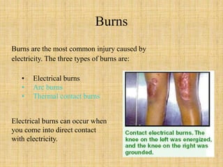 Electrical Hazards and their safety | PPSX
