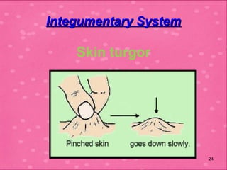 complications / Hazards of immobility | PPT