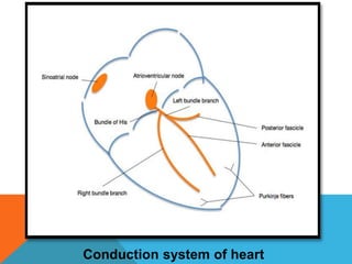 Heart Block with Nursing Management | PDF
