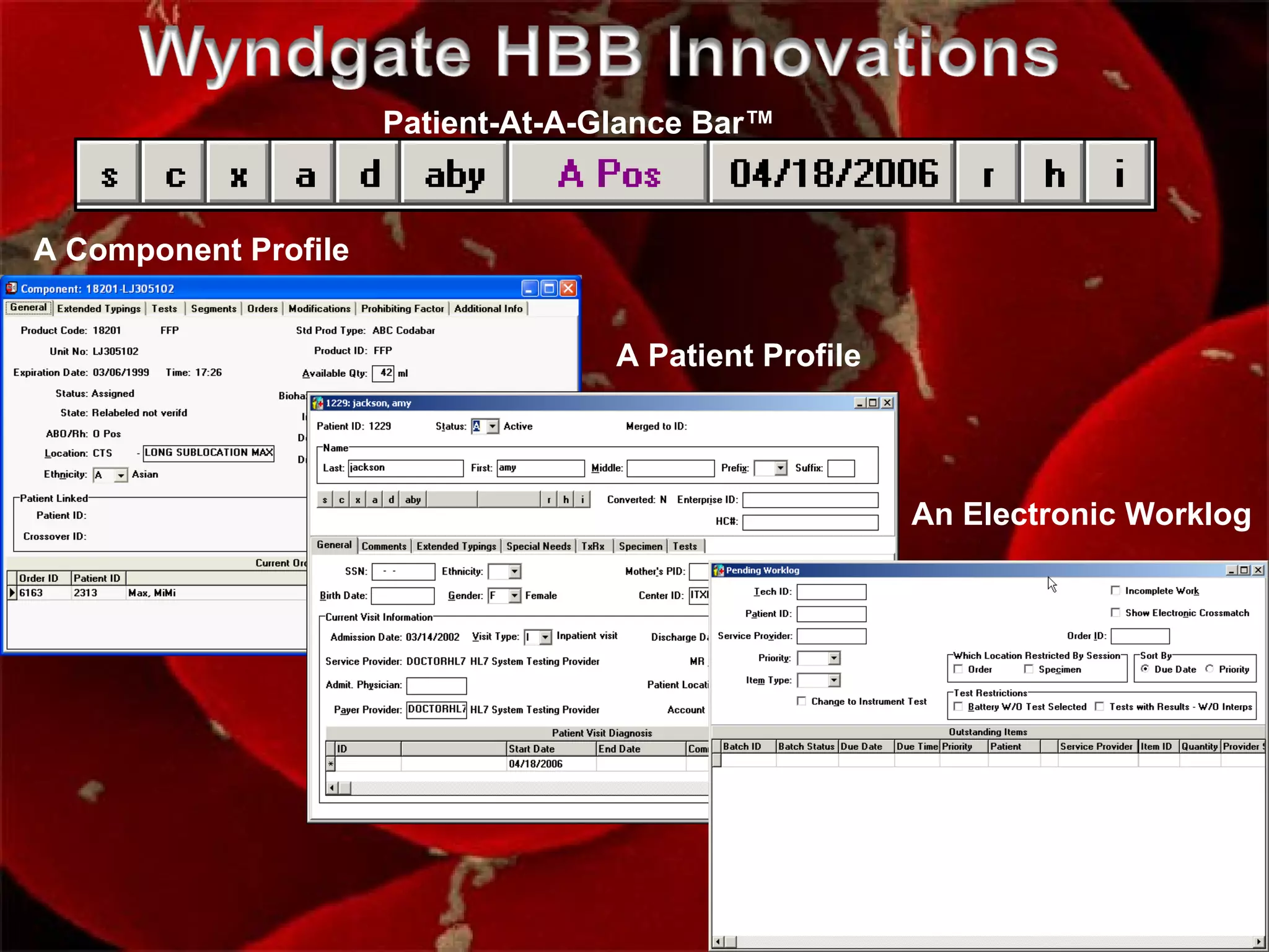 Hbb powerpoint | PPT