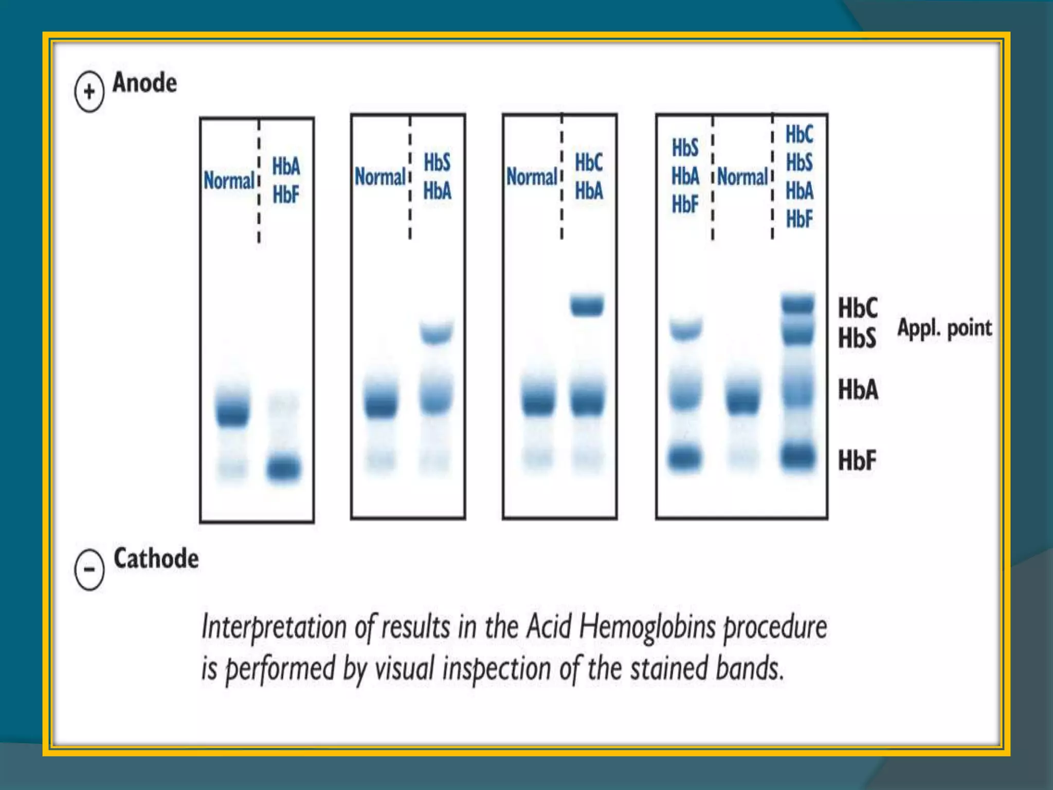 Hb electrophoresis (principle materials and procedure) | PPTX