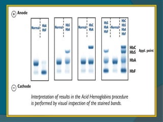 Hb electrophoresis (principle materials and procedure) | PPTX