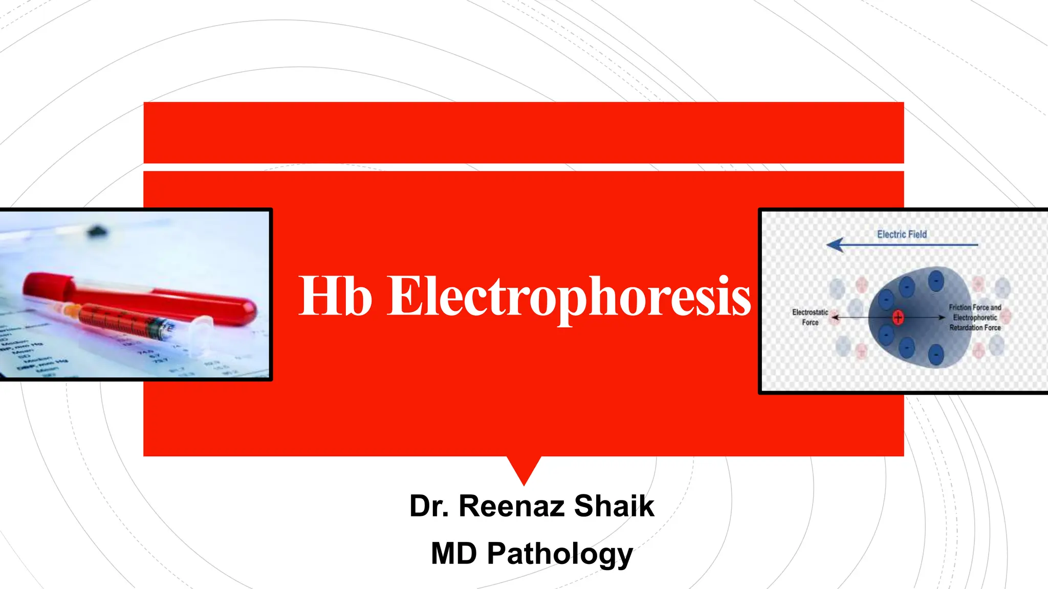 Hb electrophoresis- Types, Procedure and Analysis | PPTX