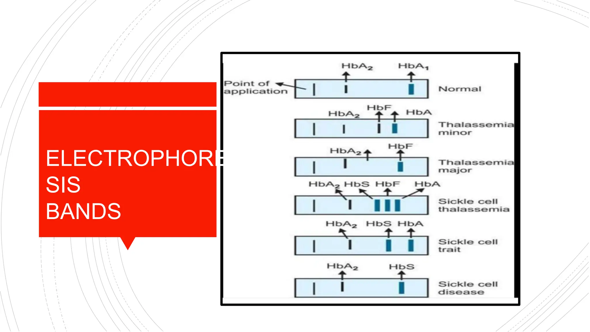 Hb electrophoresis- Types, Procedure and Analysis | PPTX