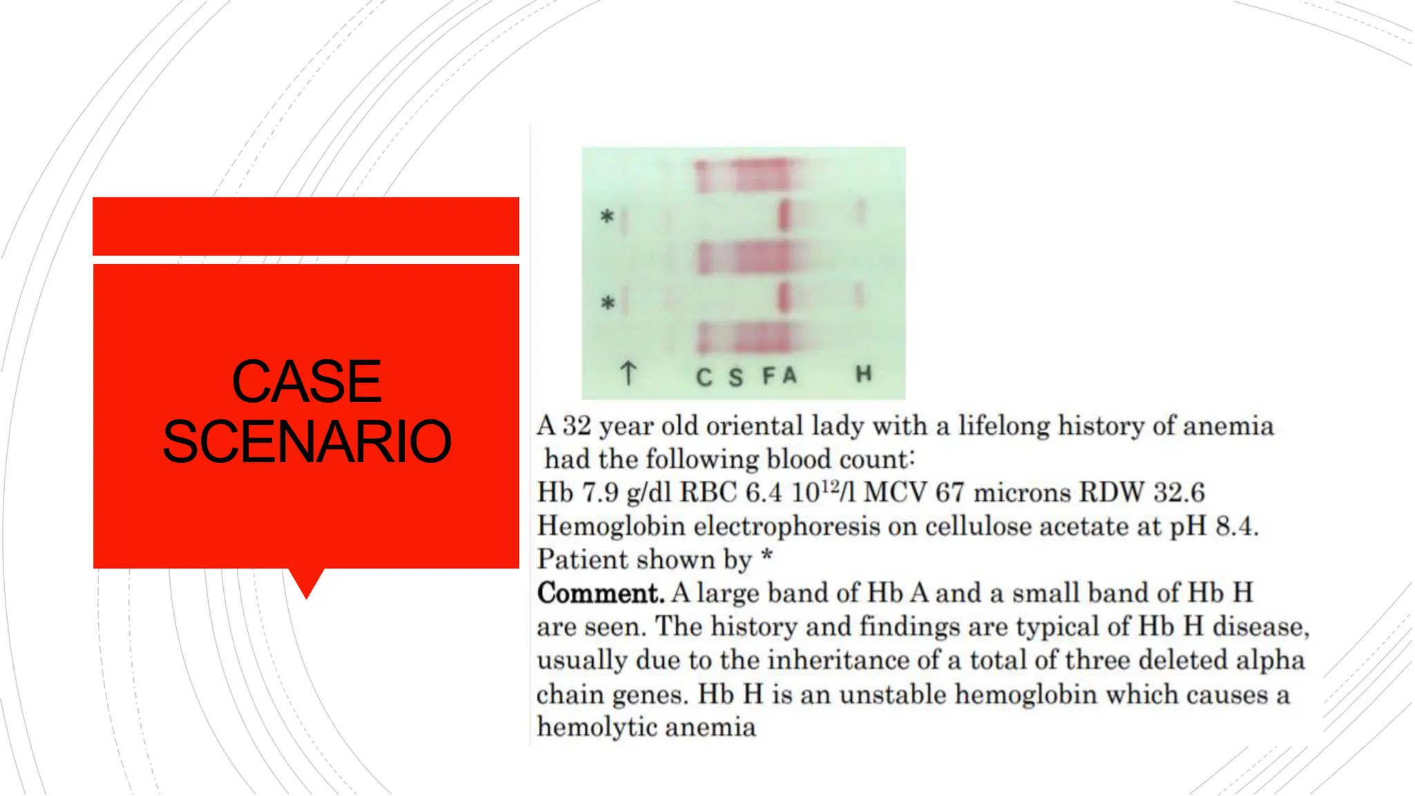 Hb electrophoresis- Types, Procedure and Analysis | PPTX