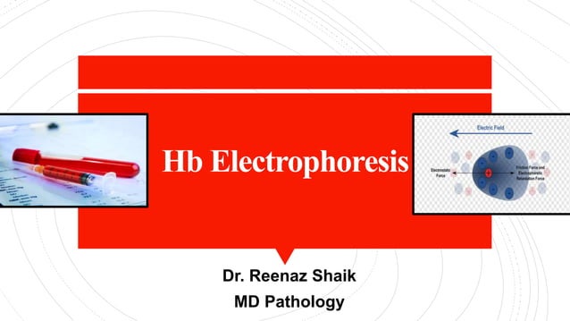 Hb electrophoresis- Types, Procedure and Analysis | PPTX | Blood ...