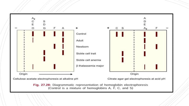 Hb electrophoresis- Types, Procedure and Analysis | PPTX | Blood ...