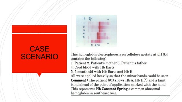 Hb electrophoresis- Types, Procedure and Analysis | PPTX | Blood ...