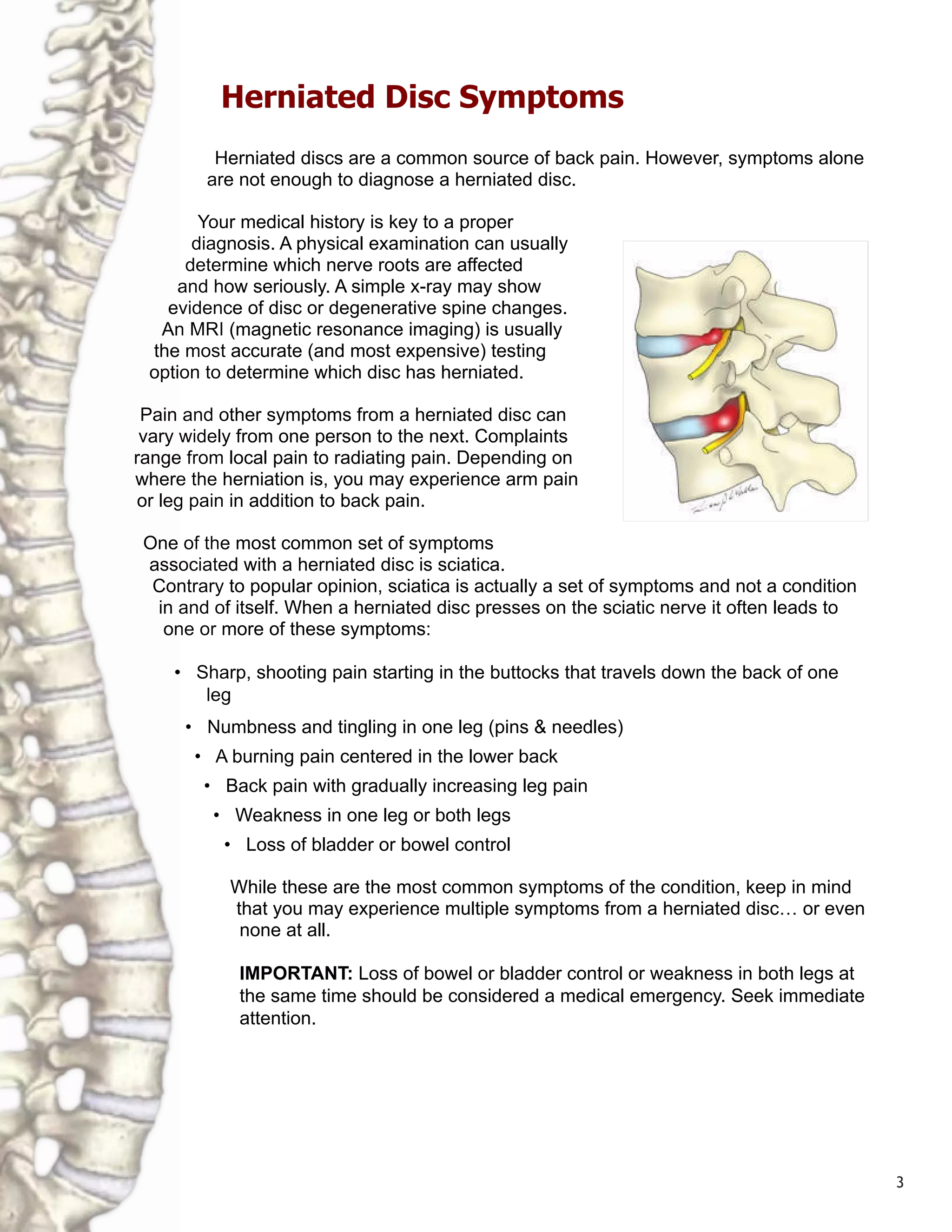 The 3-Minute Guide For Heal PHerniated Disc Pain | PDF