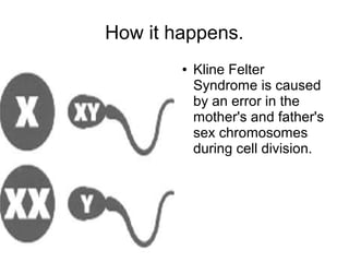 Klinefelter Syndrome HRB. | ODP