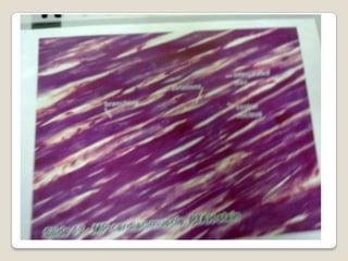 Hb lab (muscles) | PPTX