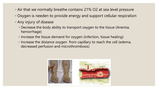Hyperbaric Oxygen Therapy in medical uses.pptx