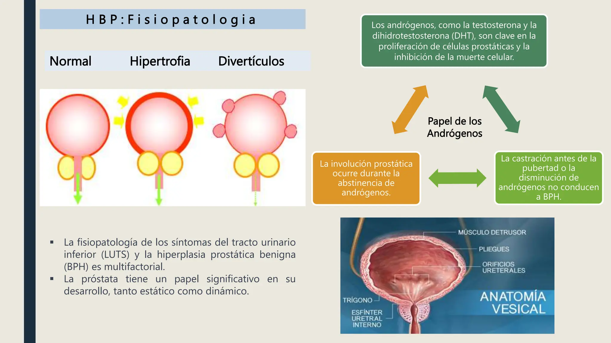 HIPERPLASIA PROSTATICA BENIGNA CLASIFICACION.pptx