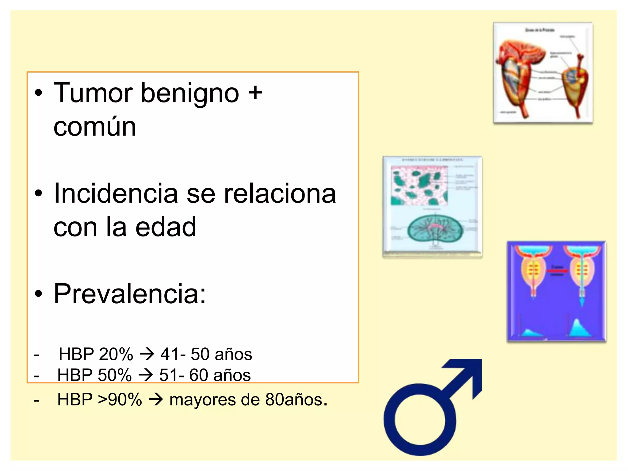 Hiperplasia Benigna de Próstata y su anatomía | PPT