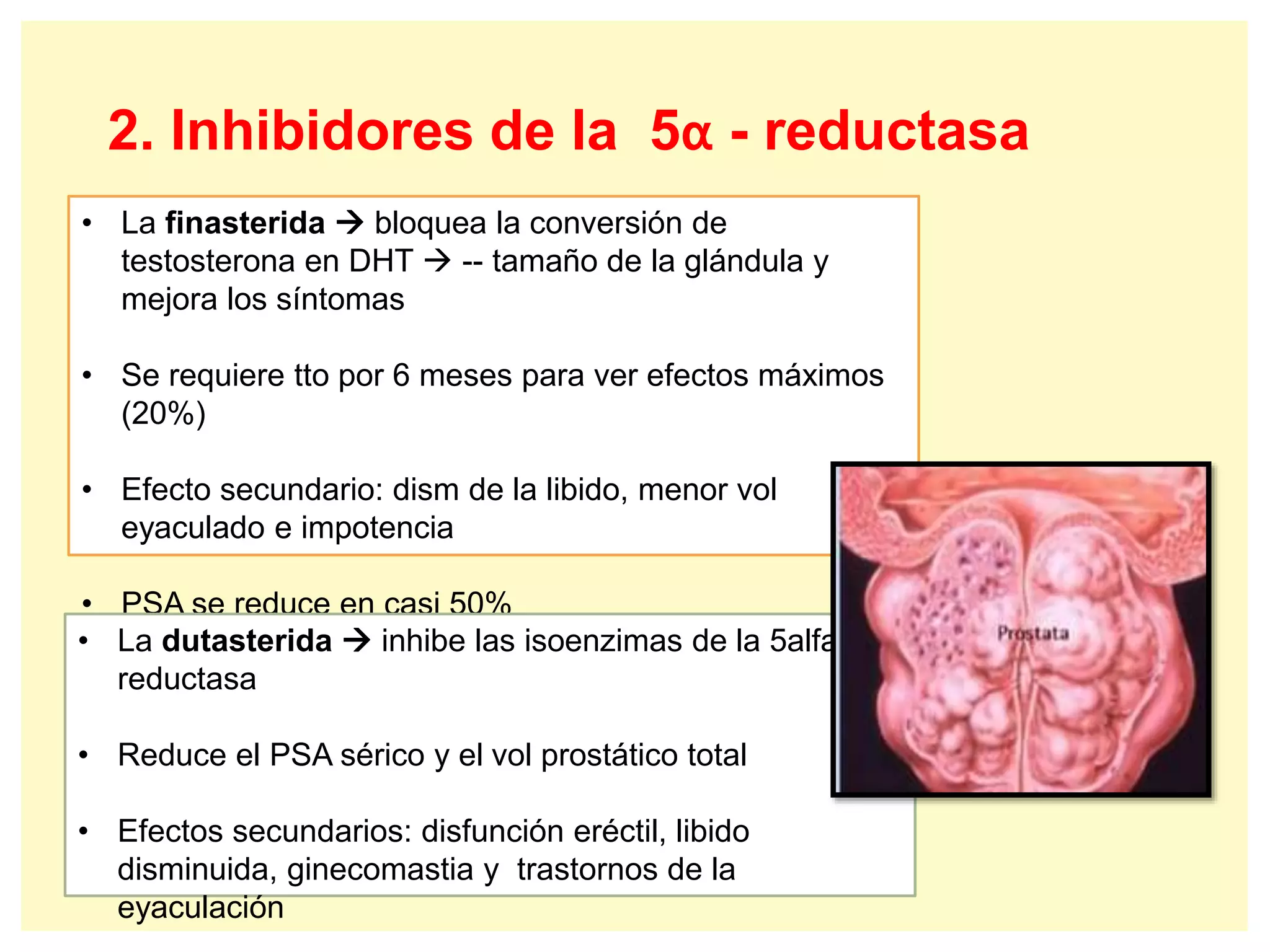 Hiperplasia Benigna de Próstata y su anatomía | PPT