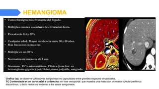 Lesiones difusas de higado- diagnostico por imagen | PPTX