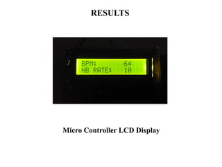 Non invasive hemoglobin estimation using iot | PPT