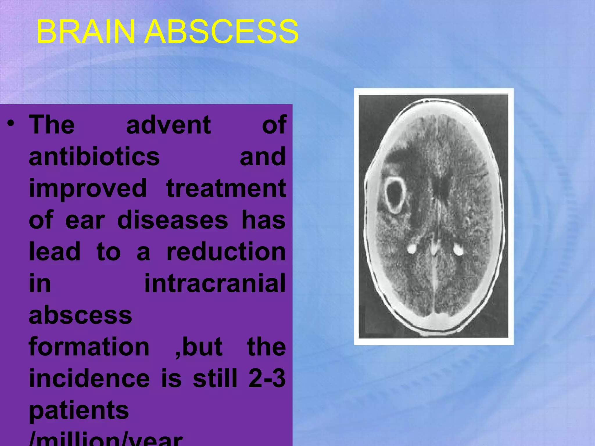 BRAIN ABSCESS | PPT