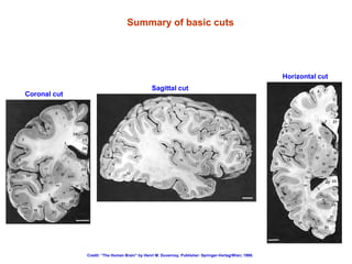 An Introduction To Human Neuroanatomy | PDF