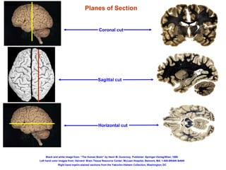 An Introduction To Human Neuroanatomy | PDF