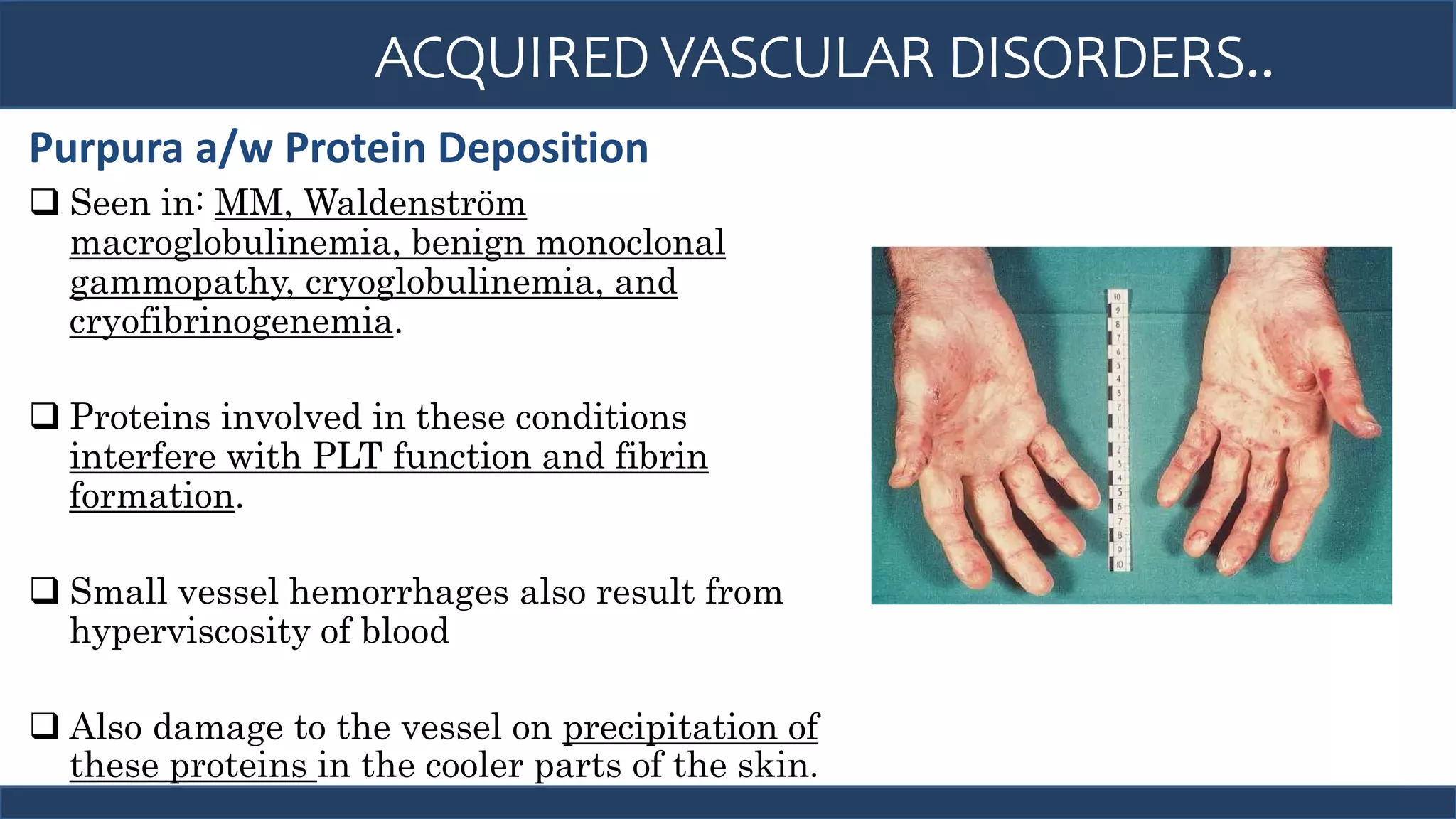 NORMAL HEMOSTASIS, PLATELET AND VASCULAR DISORDERS | PPTX