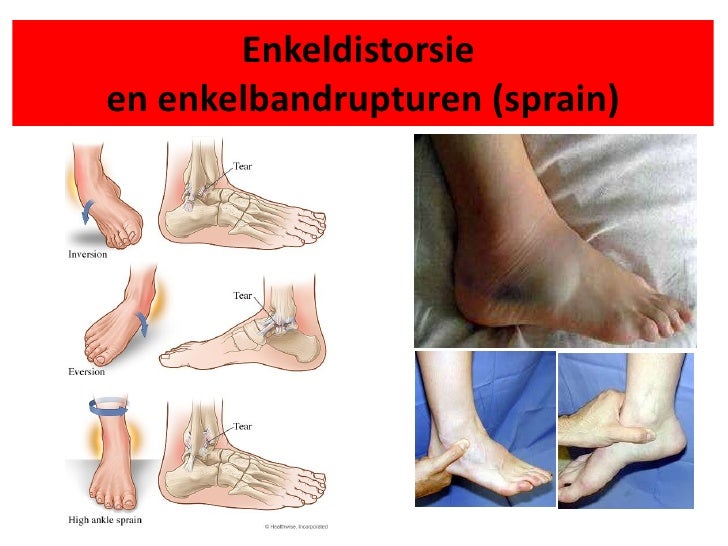 Hc 2.2.12 'sportletsels thv het ol (deel 2)' aj 20102011