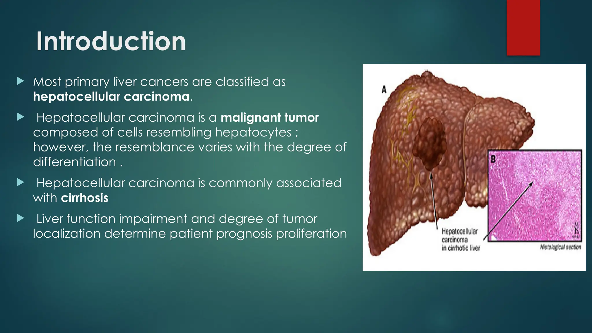 Hepatocellular carcinoma,a type of cancerpptx | PPTX | Cancer ...