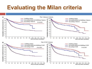 Hcc beyond milan | PPTX