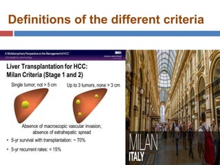 Hcc beyond milan | PPTX