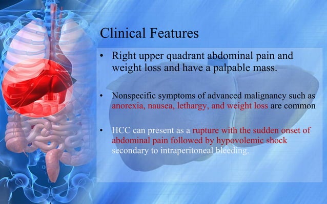 Hepatocellular Carcinoma- At a Glance | PPT