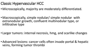 Hcc(hepatocellular carcinoma) | PPTX