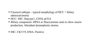 Hepatocellular carcinoma | PPTX | Cancer | Diseases and Conditions