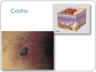 Historia Clínica Dermatológica y Lesiones Elementales | PPTX