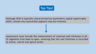 Echocardiographic Evaluation of Hypertrophic Cardiomyopathy | PPTX