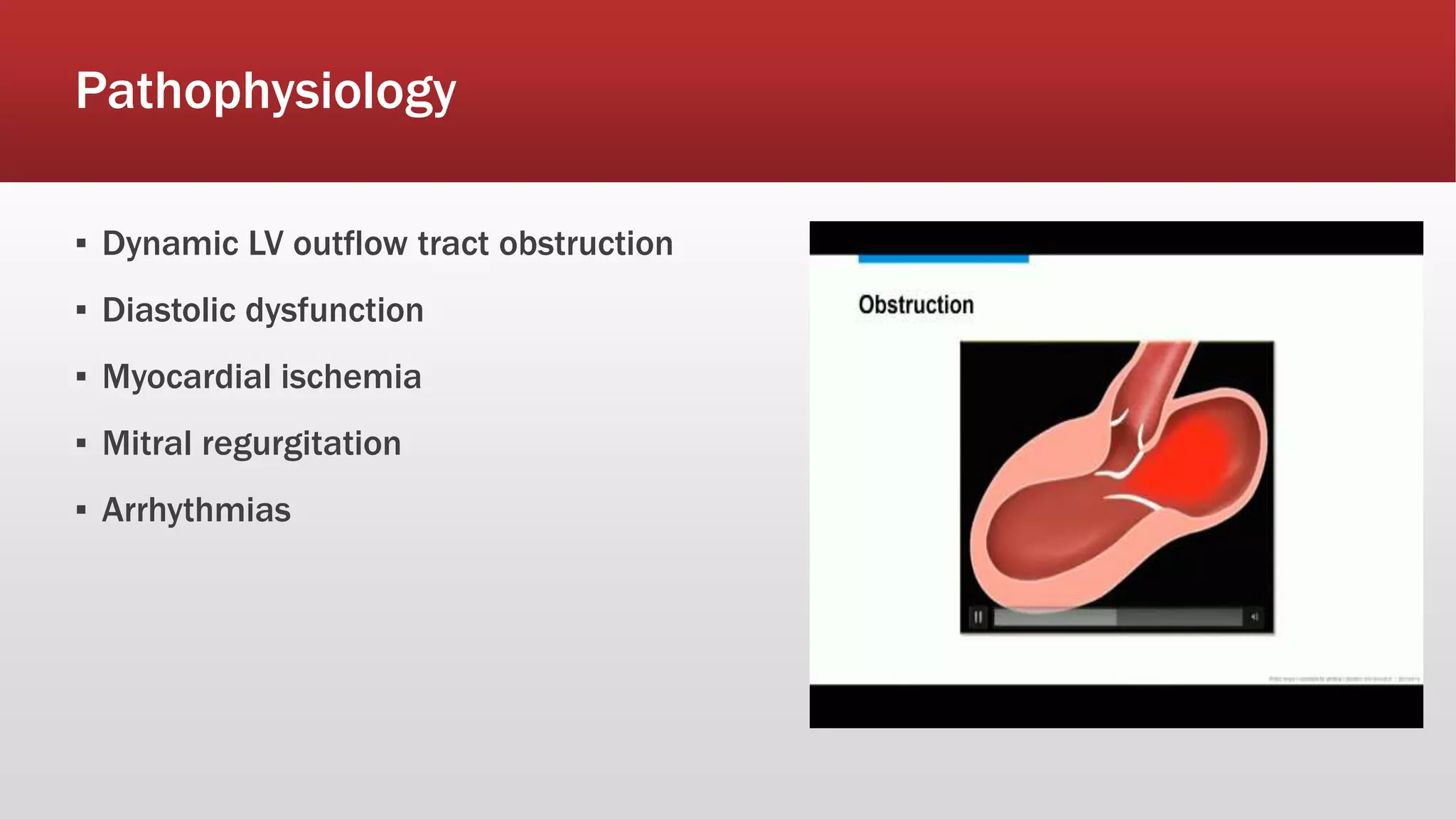 HCM Hypertrophic cardiomyopathy.pptx
