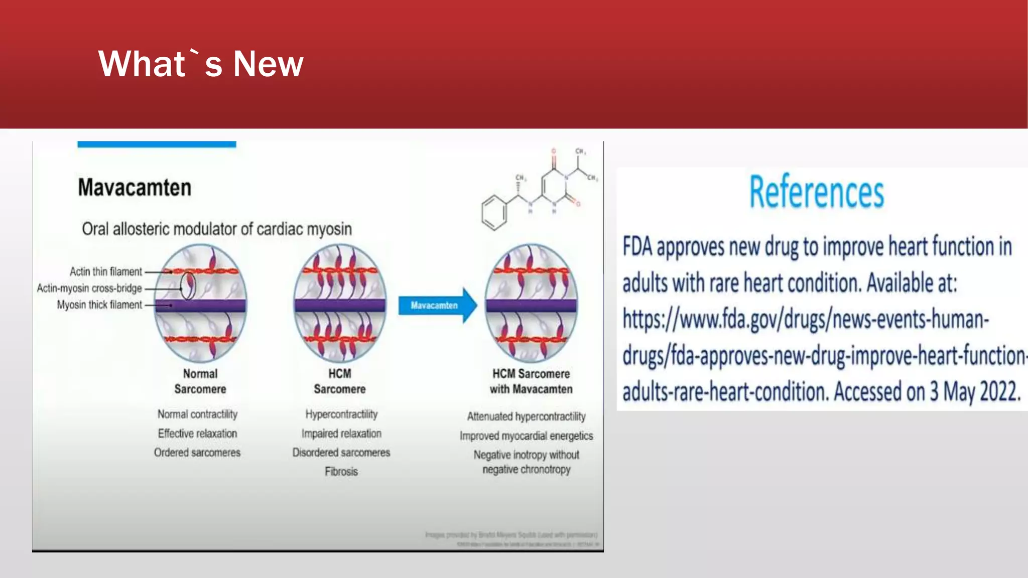 HCM Hypertrophic cardiomyopathy.pptx