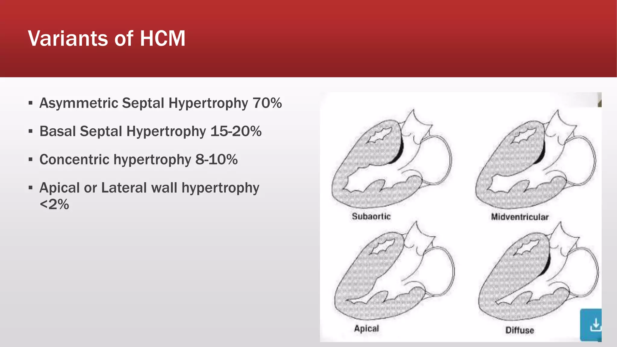 HCM Hypertrophic cardiomyopathy.pptx